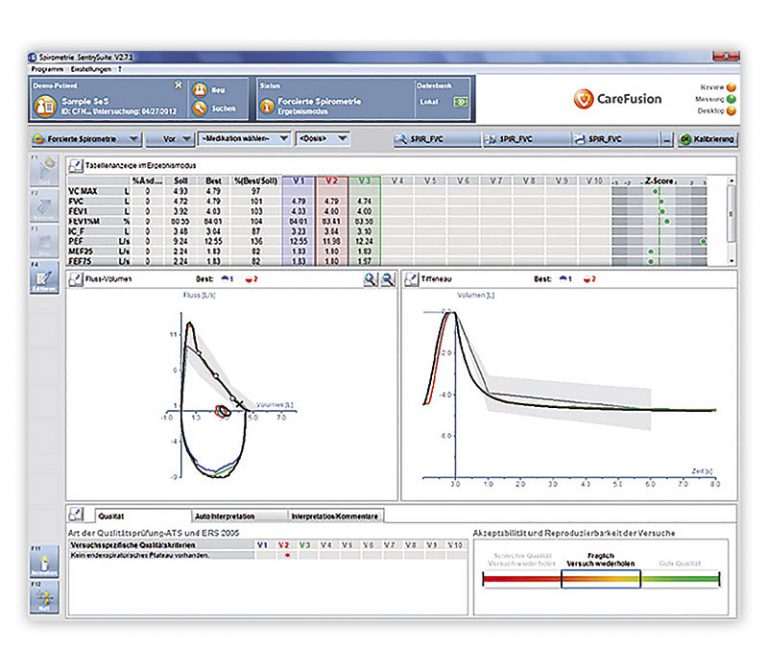 Spirometer | KS Medizintechnik
