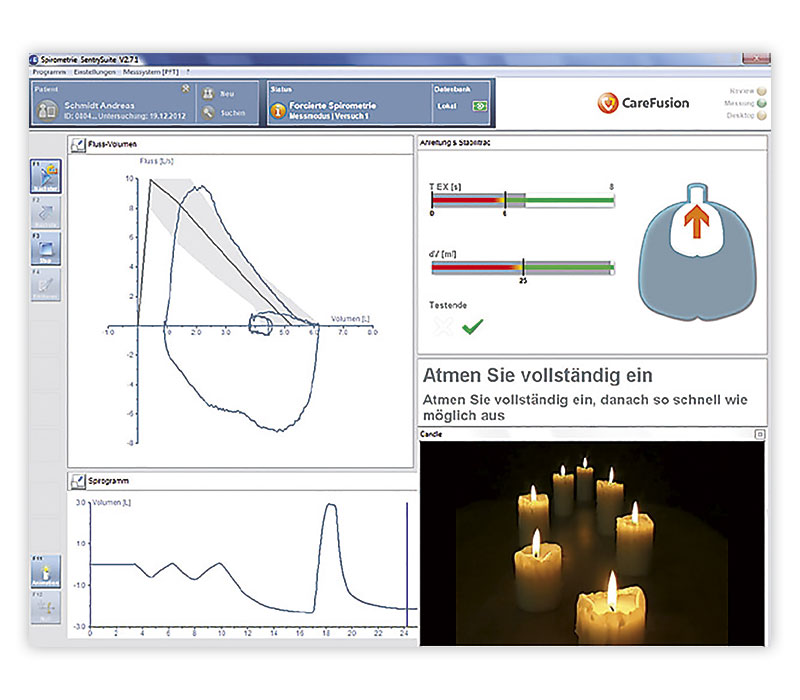 CareFusion Vyntus Spiro PC-Spirometer | KS Medizintechnik