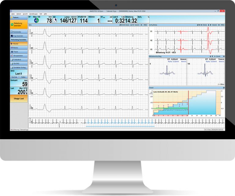 AMEDTEC ECGpro Datenmanagement | KS Medizintechnik